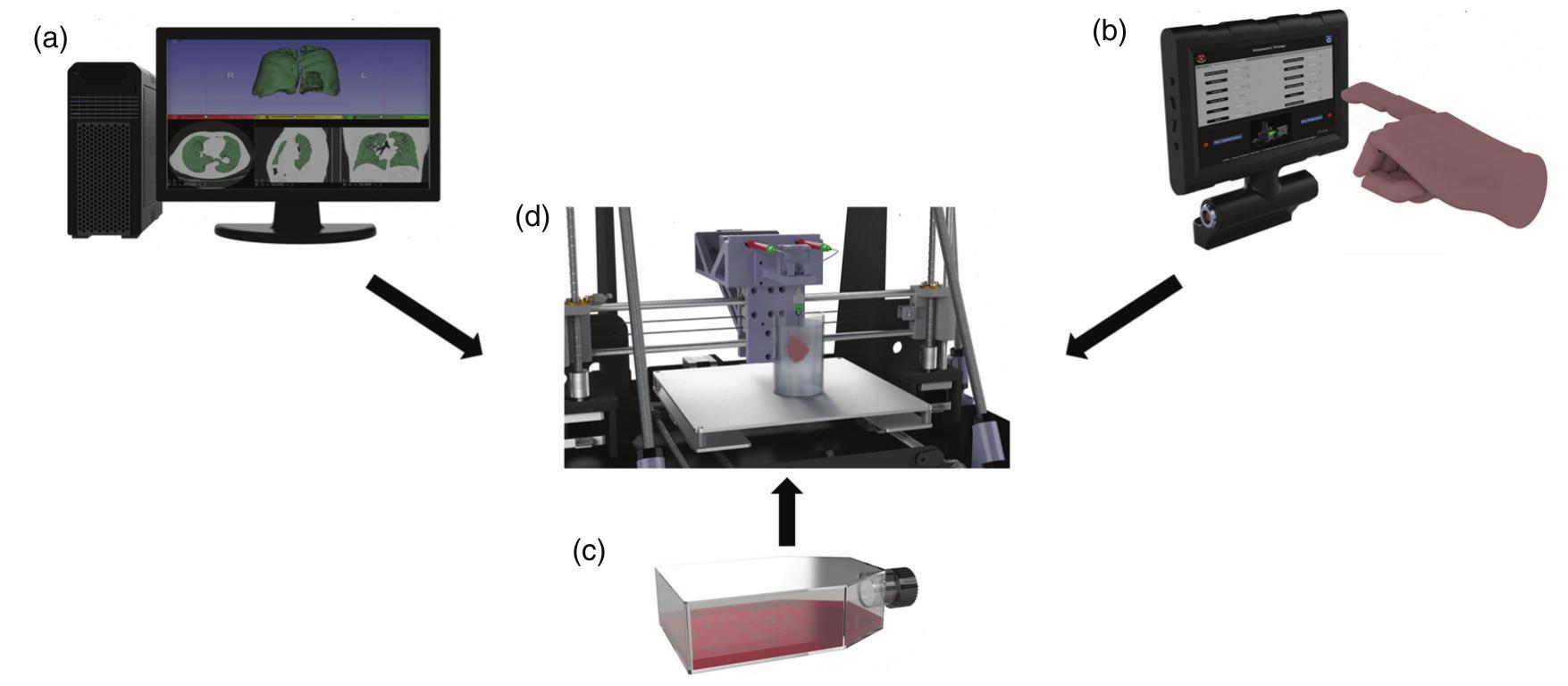 Bioprinting process flow diagram. (a) ct scan of a patient