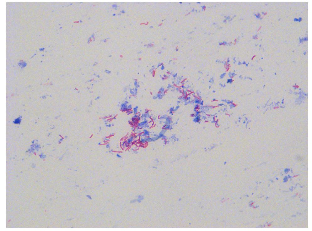 Optical microscopy images of a biofilm sample from the