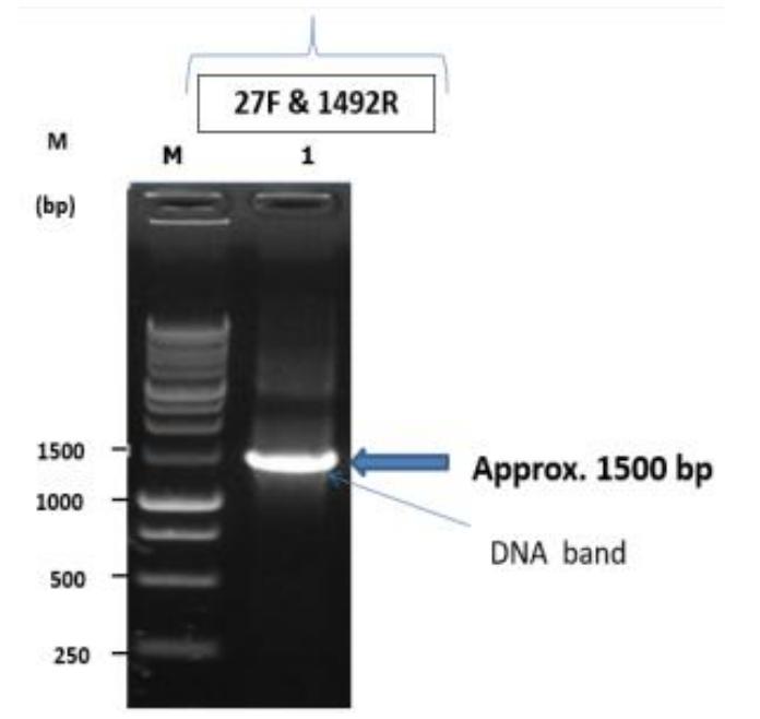 Pcr amplification of soil bacteria using 1492r and 27f