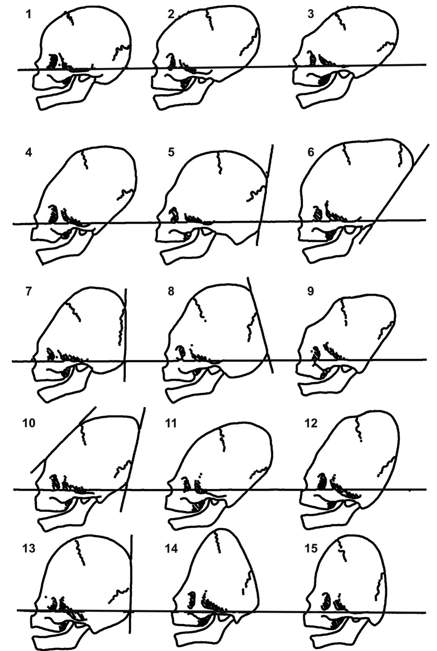 Figure 3 - from Cranial modification and the shapes of heads