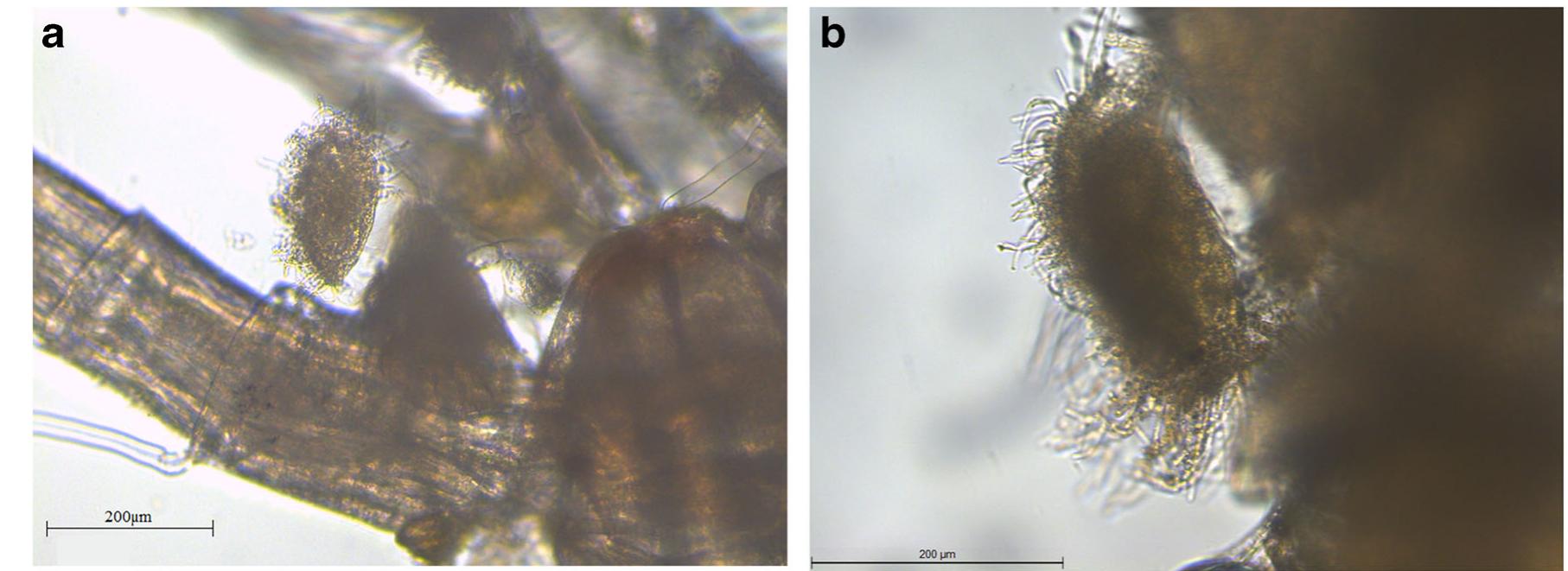 Light micrograph (lm) of epibiontic species, scale bar, 200