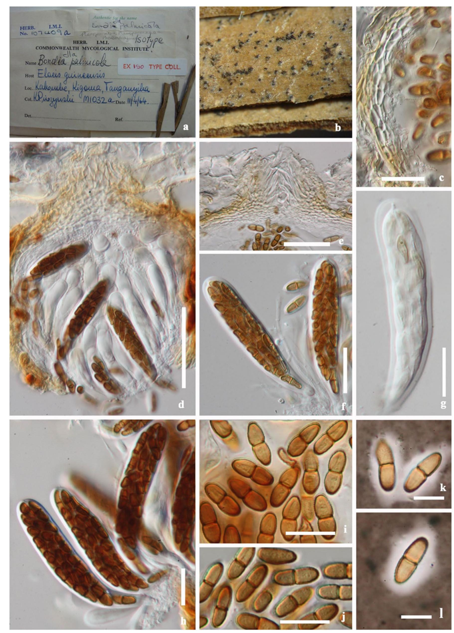 Ascospores In Asci