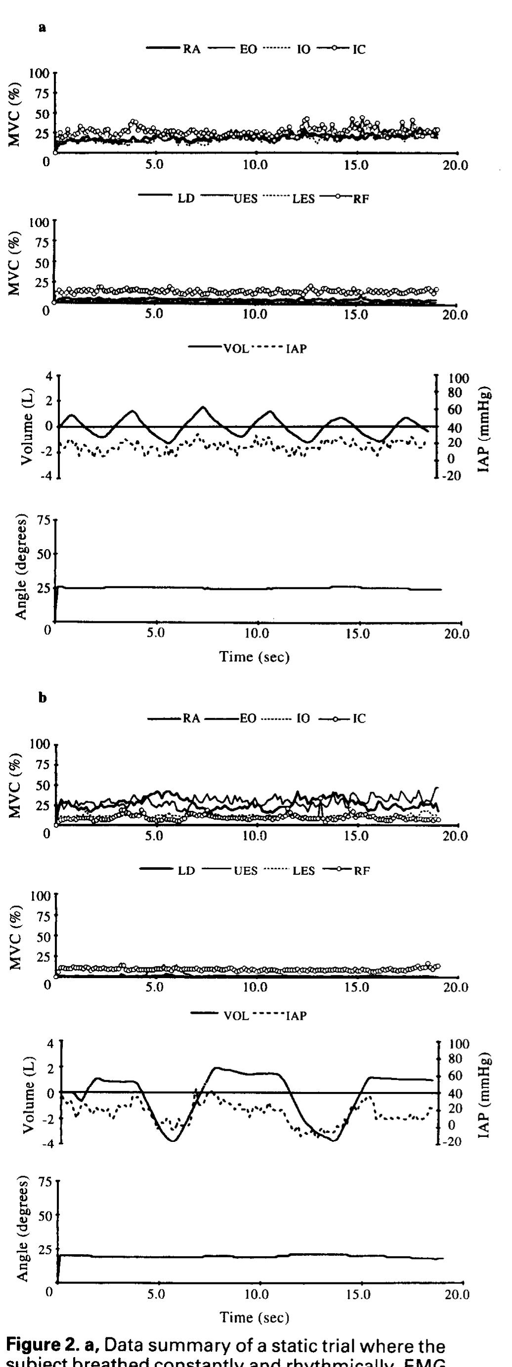Figure 2 - The mechanics of torso flexion: situps and