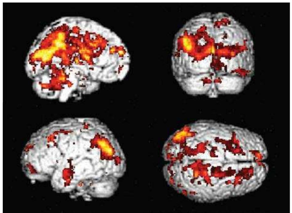 7igure 5. mri pictures showing different brain areas