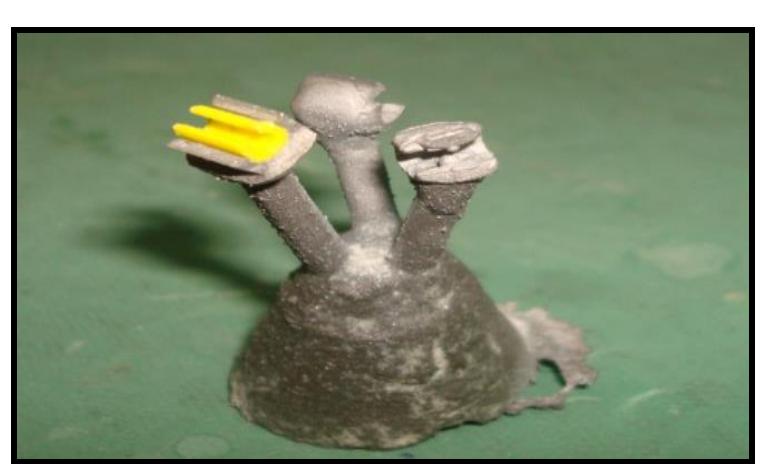 Figure 5 - from A Customized Semi- Precision Bar Attachment