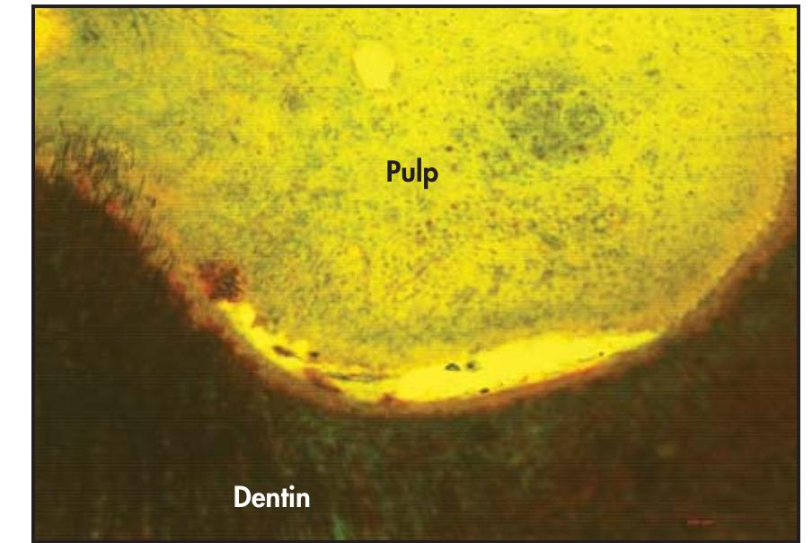 Image at 50x under a confocal scanning laser microscope.