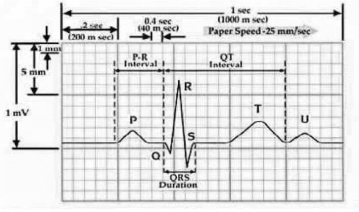 Typical one-cycle ecg signal tracking
