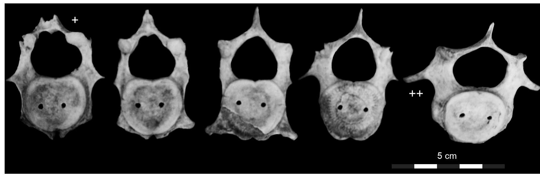 Cervical vertebrae (c3 to c7) of lagenorhynchus australis