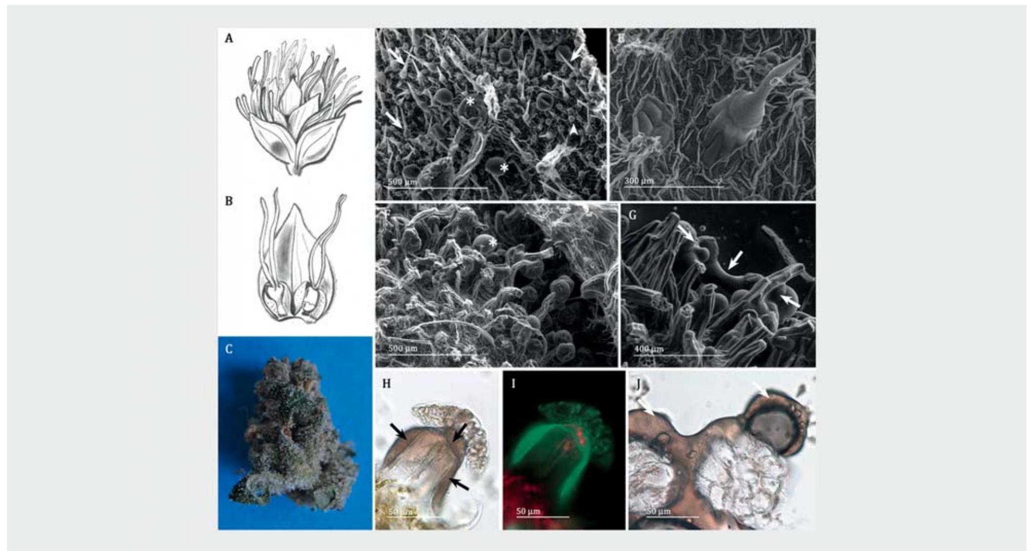 > fig. 1 a,b illustrations of the typical structure of a
