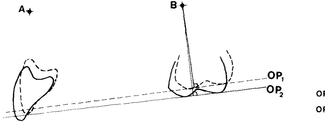 Figure 2 - Condylar development and mandibular rotation and