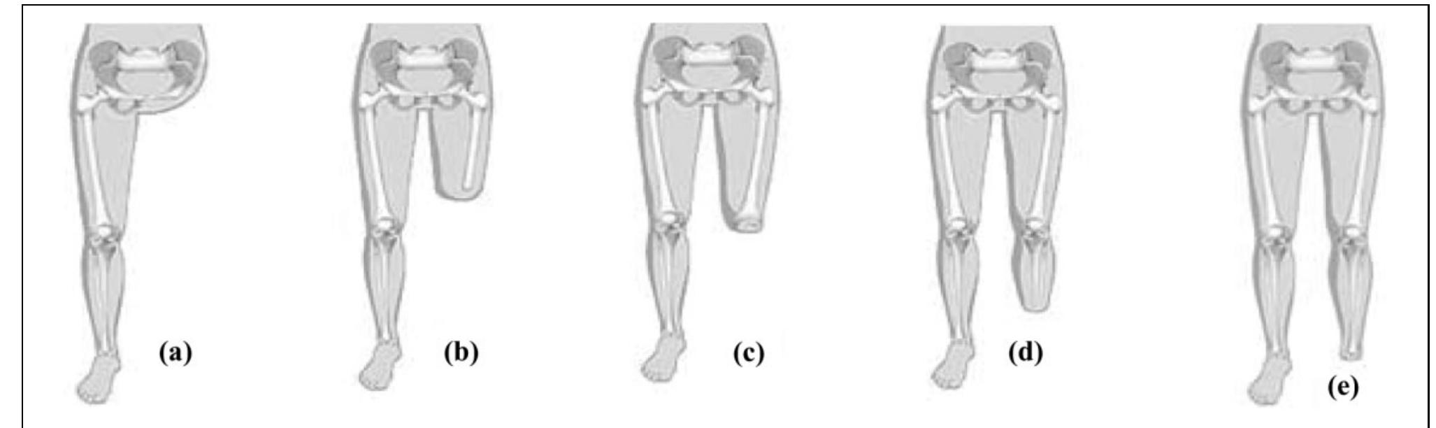 Figure 5 - from Lower-limb exoskeletons