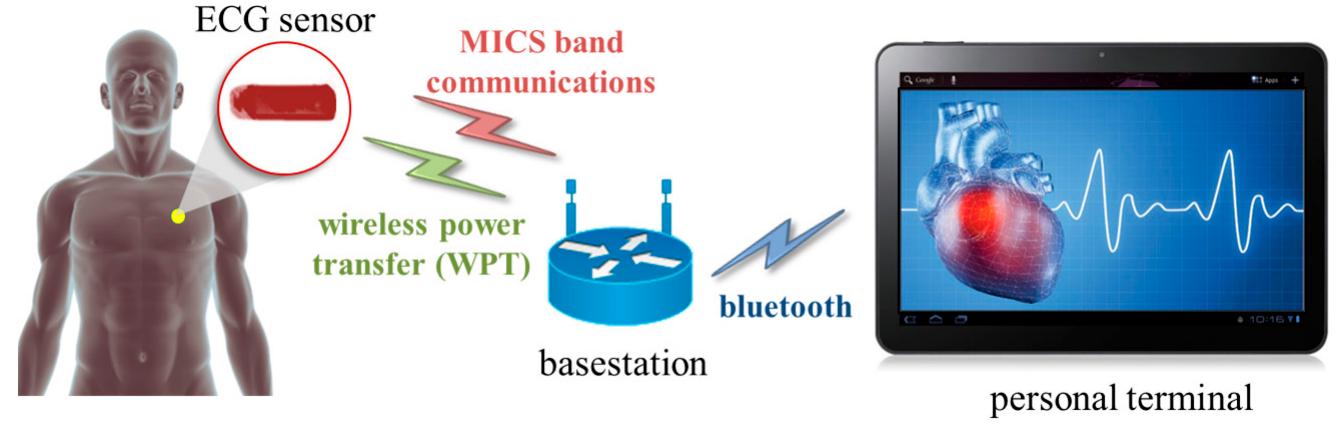 Electrocardiogram (ecg) monitoring system diagram. figure 1