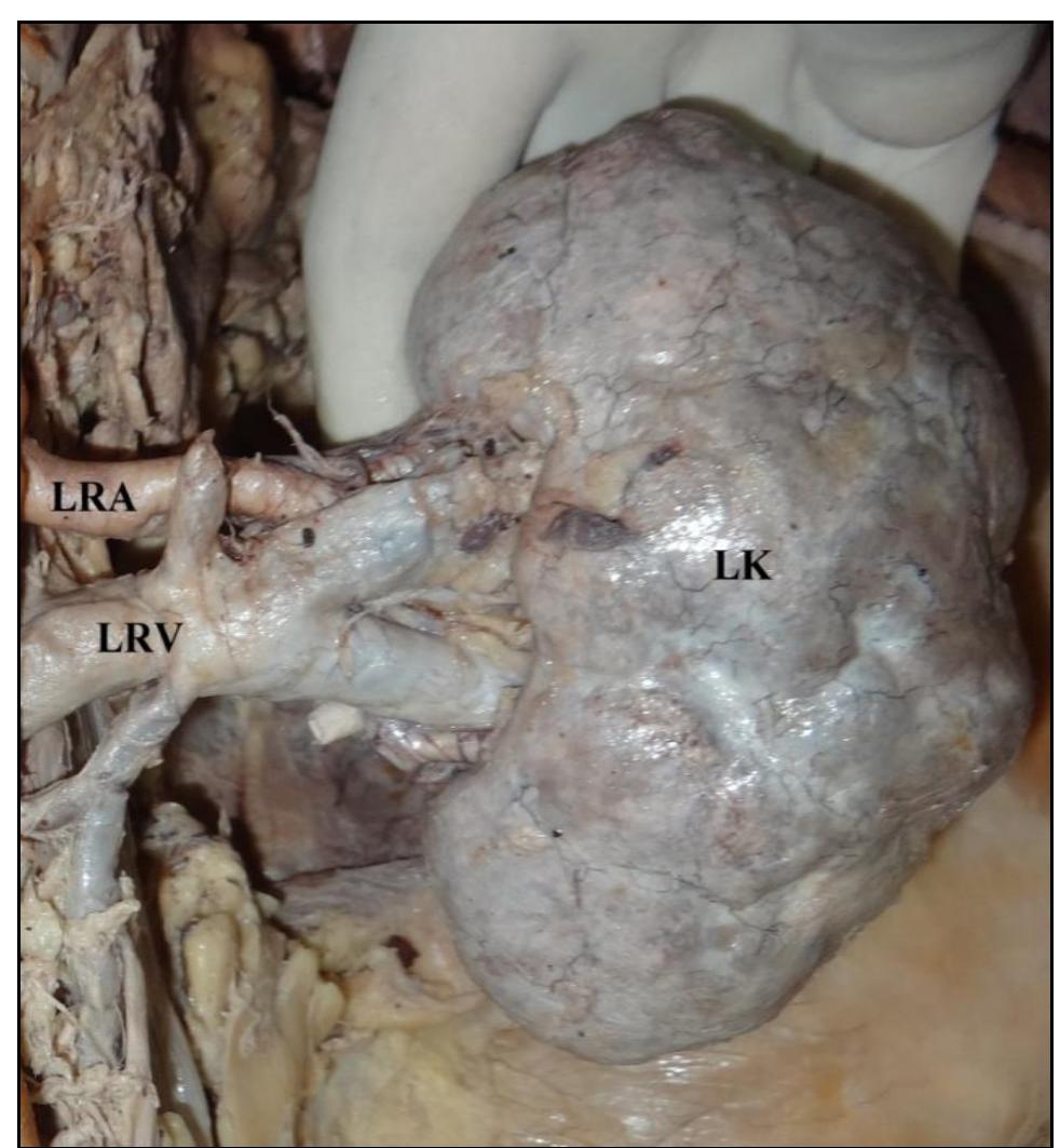 Figure 4 - from A cadaveric study on anatomical variations