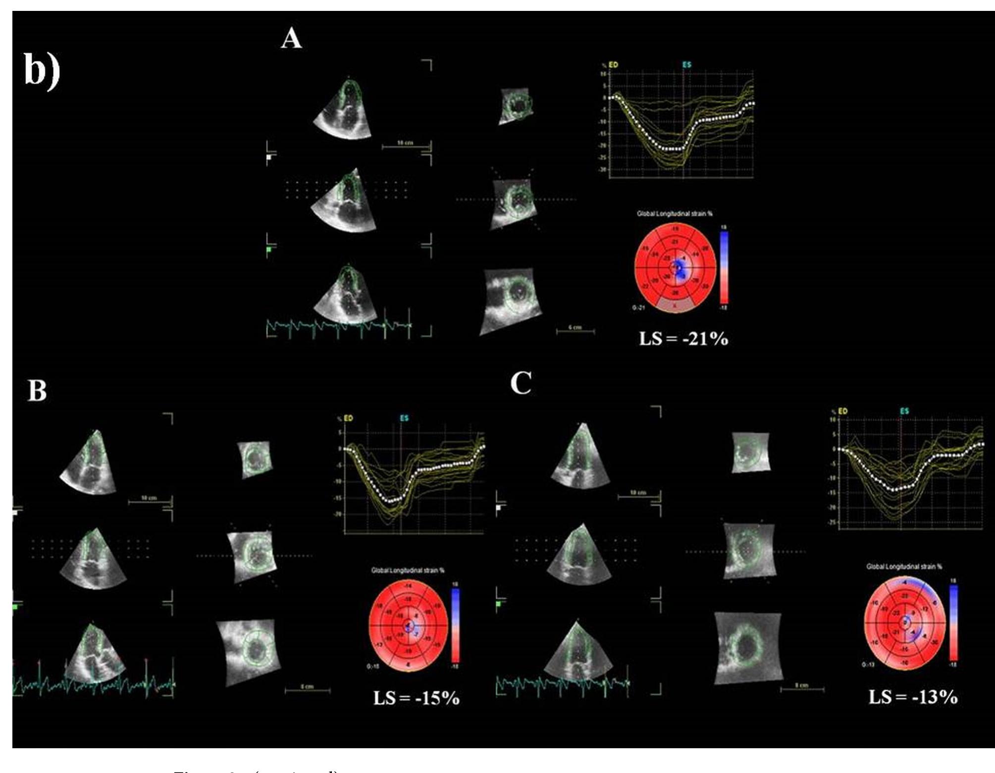 Figure 4 - 3D echocardiography, arterial stiffness, and