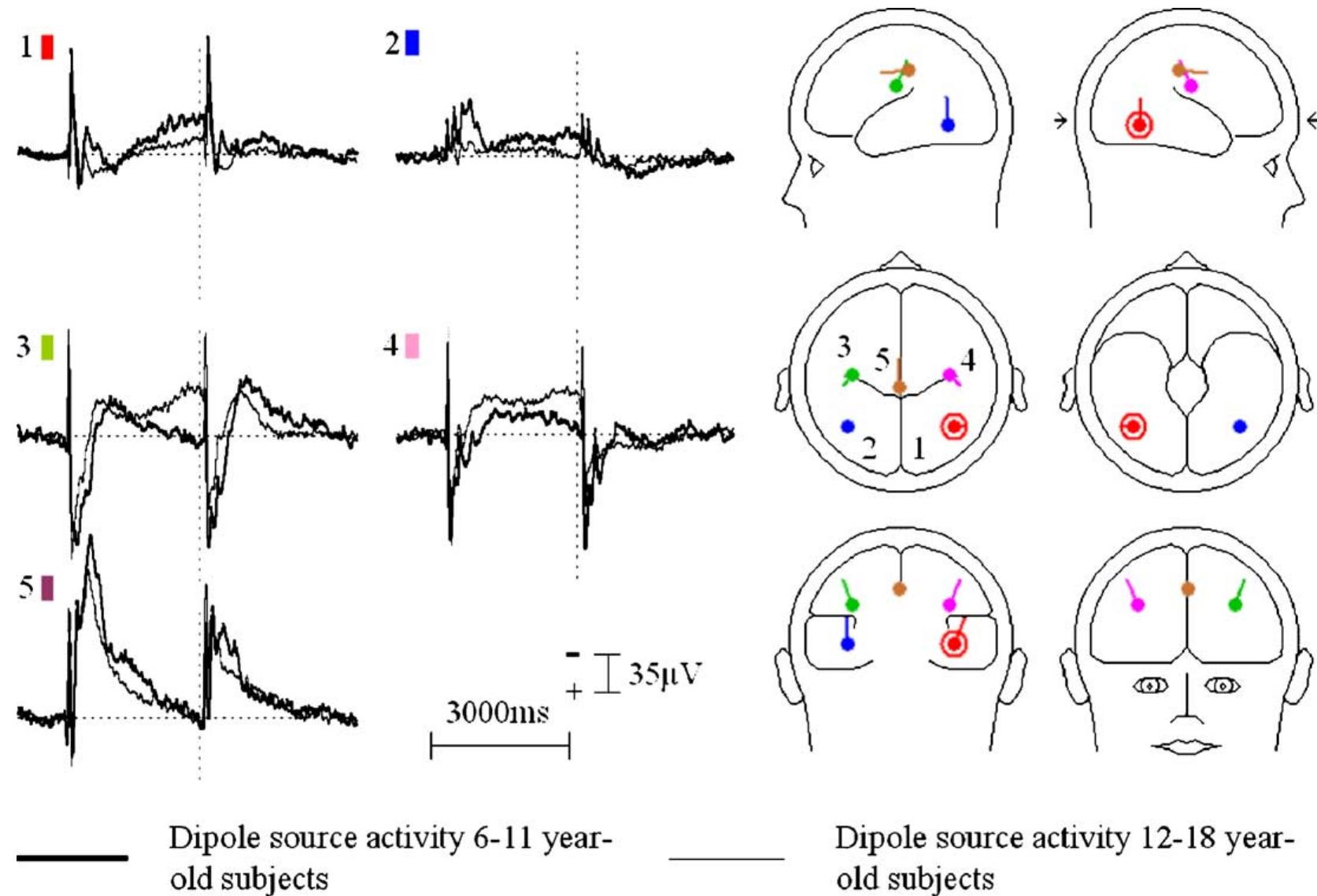 Dipole source analysis. right: dipole model for late cnv