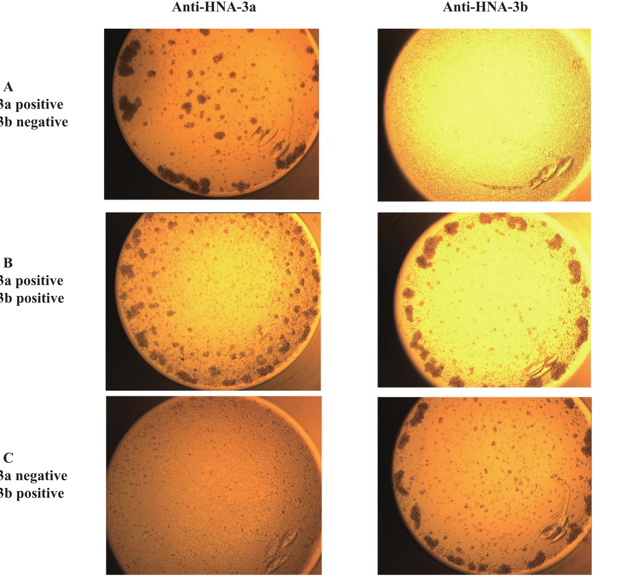 Results of phenotyping by the gat. phenotypes of three