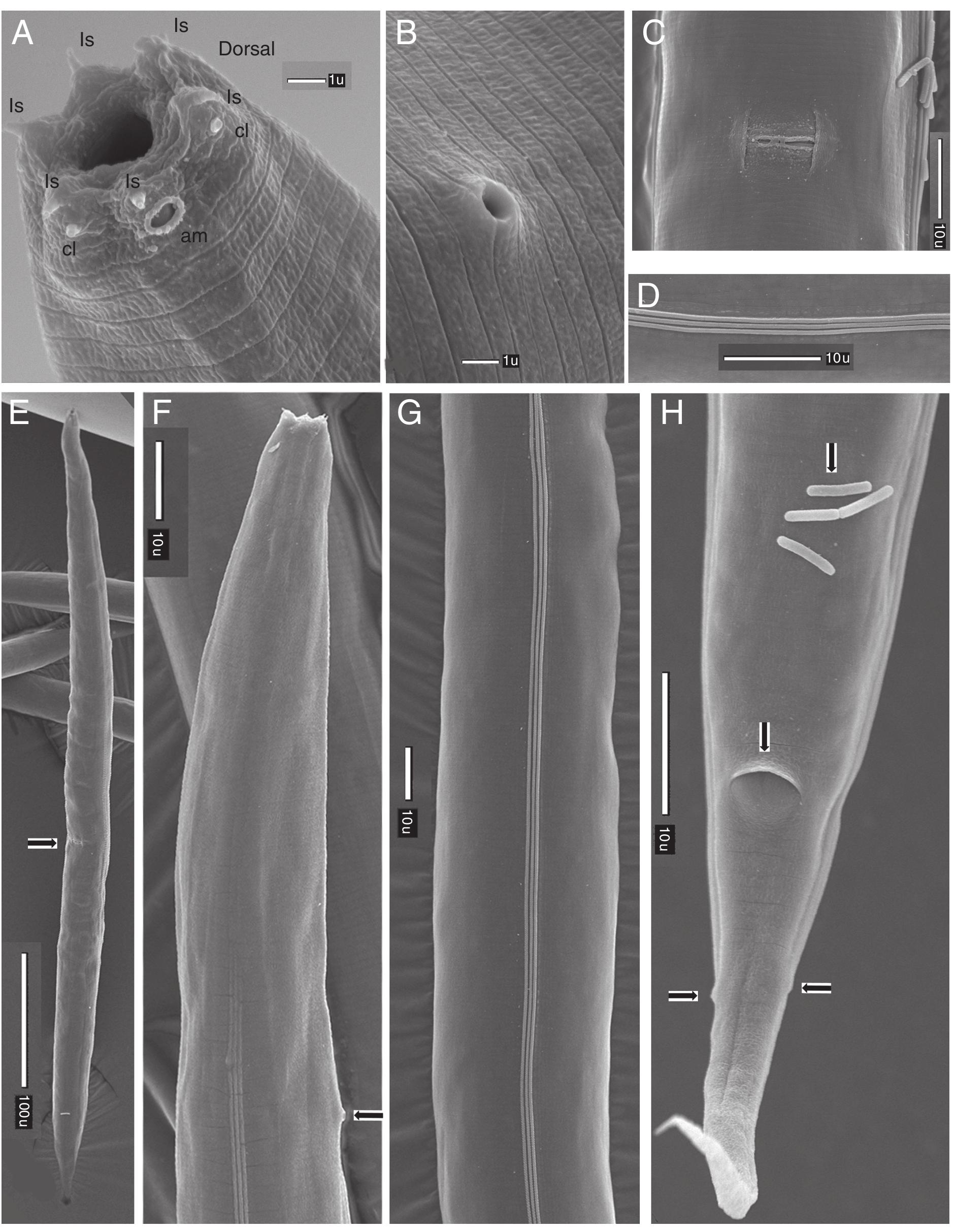 Scanning electron microscope photographs of oscheius onirici