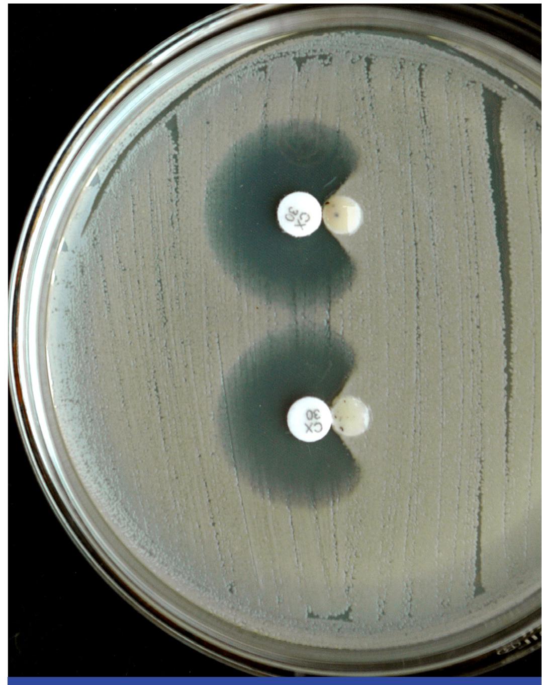 [table/fig-3]: positive ampc test (indentation of the zone