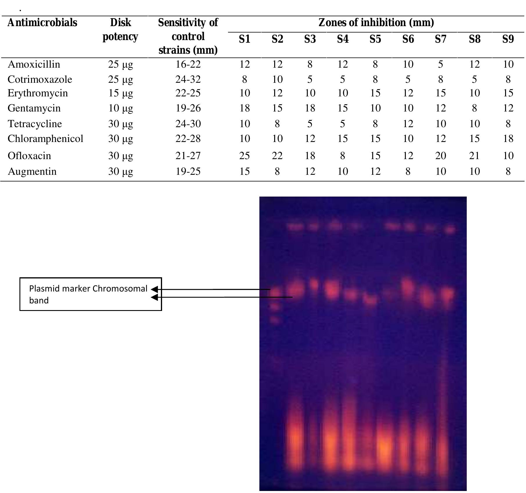 Antibiotic resistance patterns and zones of inhibition of