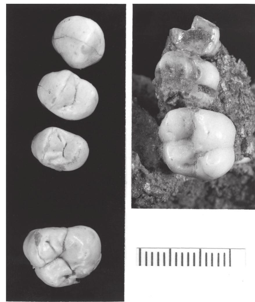 occlusal views of the cisterna right maxillary teeth.