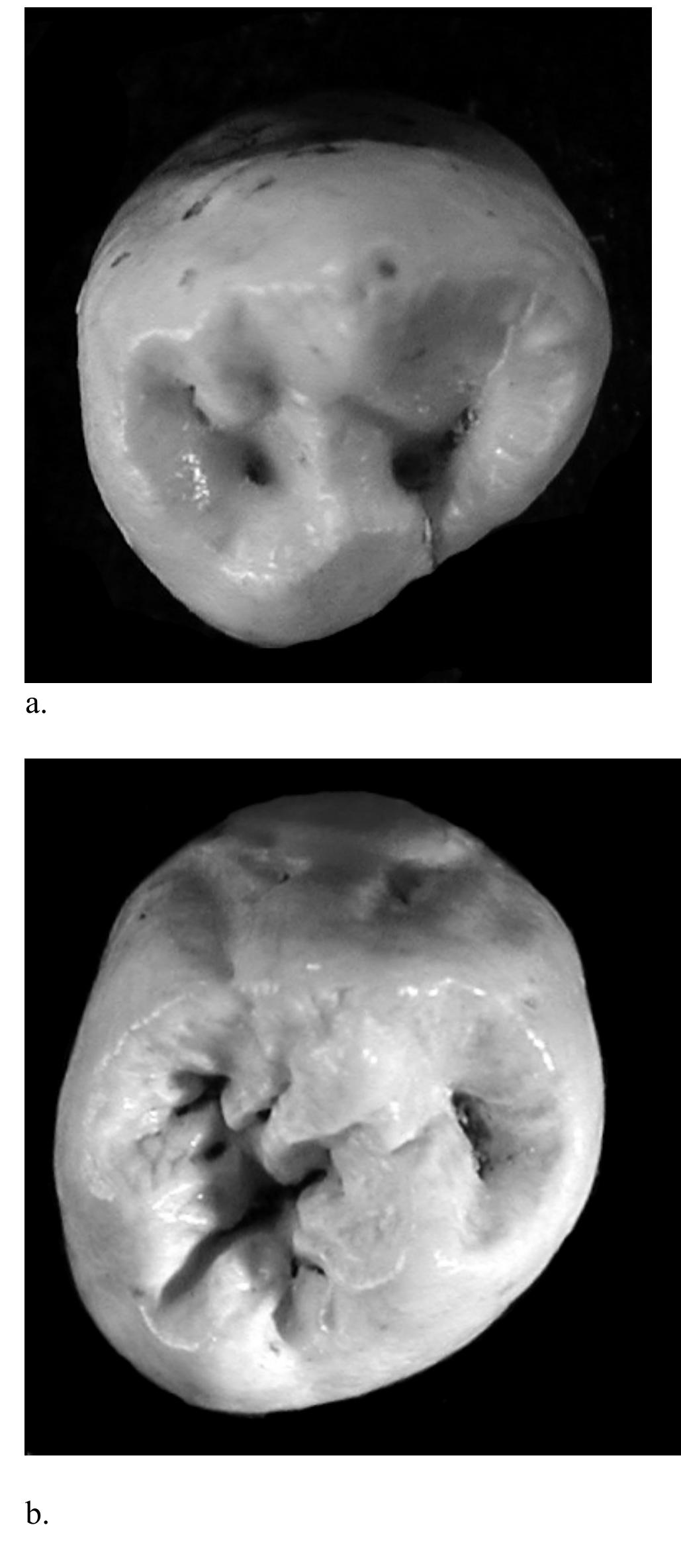 Figure 15 - Neandertal dental morphology: implications for