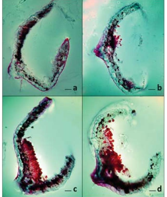 Figure 2 - Research Note: Histopathology of Puccinia