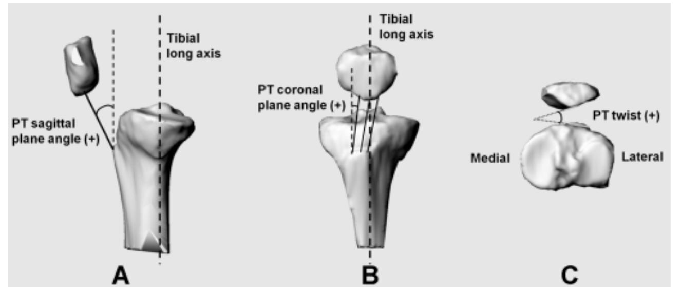 Figure 4 - In-vivo patellar tendon kinematics during
