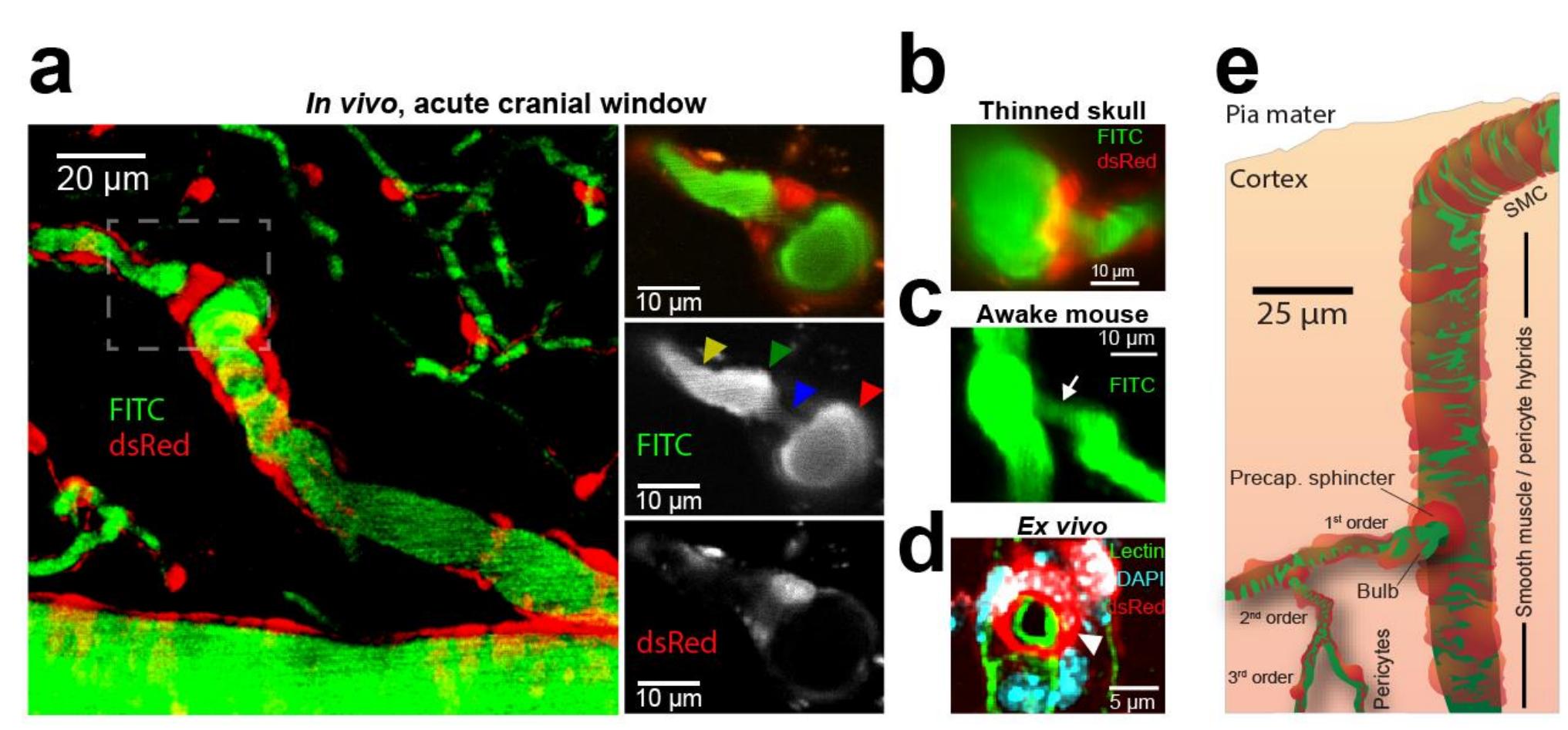 precapillary sphincters are found on the proximal