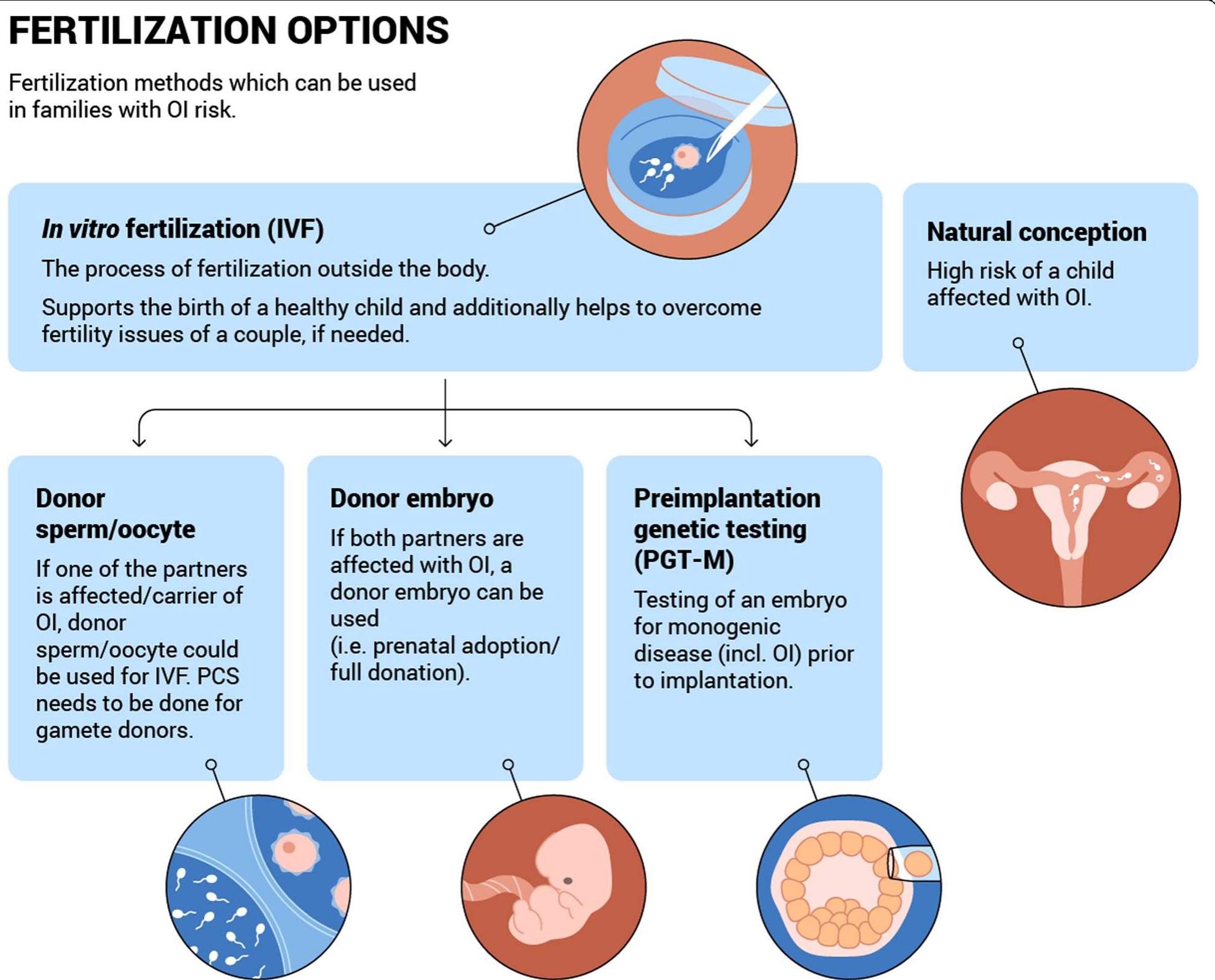 Overview of fertilisation options for couples with ol risk.