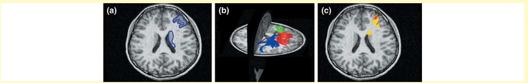 I. (a) structural mri produces structural images of the