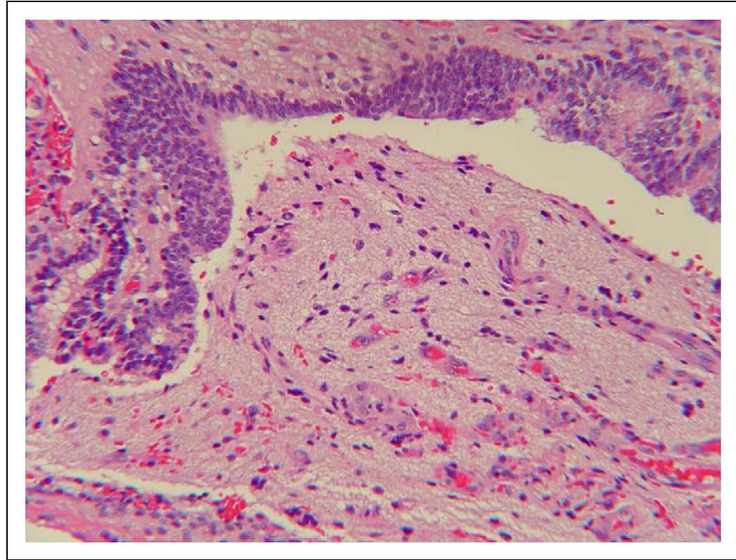 Ependyma-like cells around terminal ventricle-like space.
