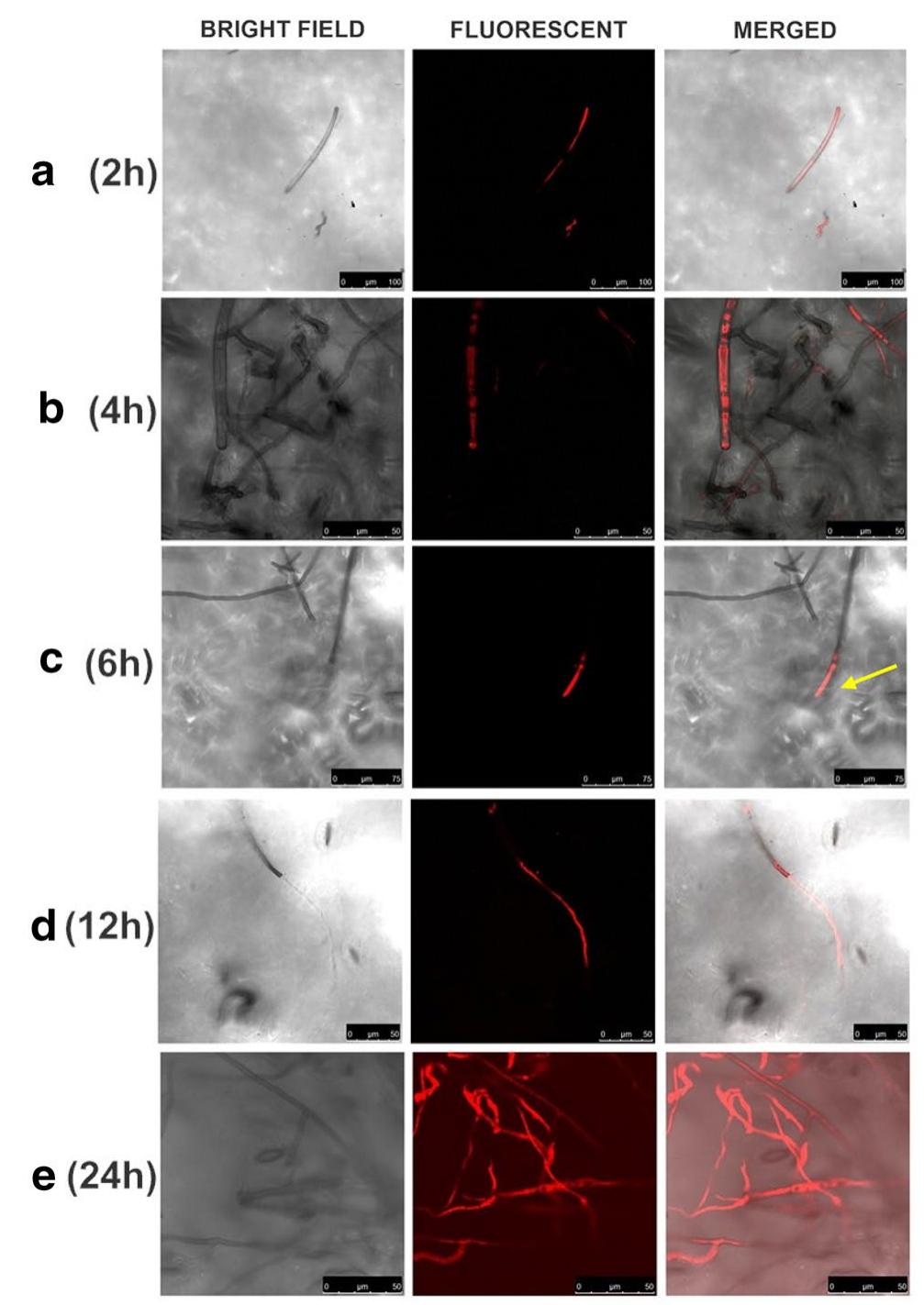 Confocal images of leaf infection assay using dsred trans-