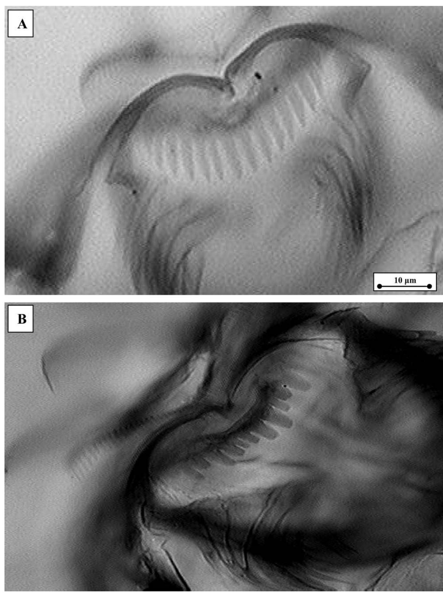 _deformities of pectin epipharyngis of chironomus spp.