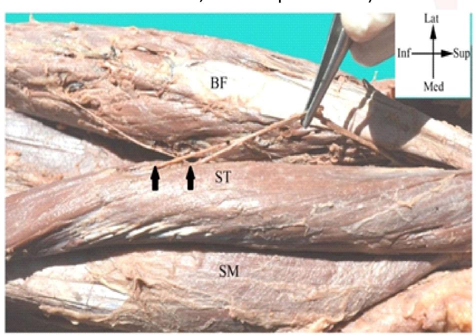 Figure 1 - Anatomical Localization of Motor Entry Points of
