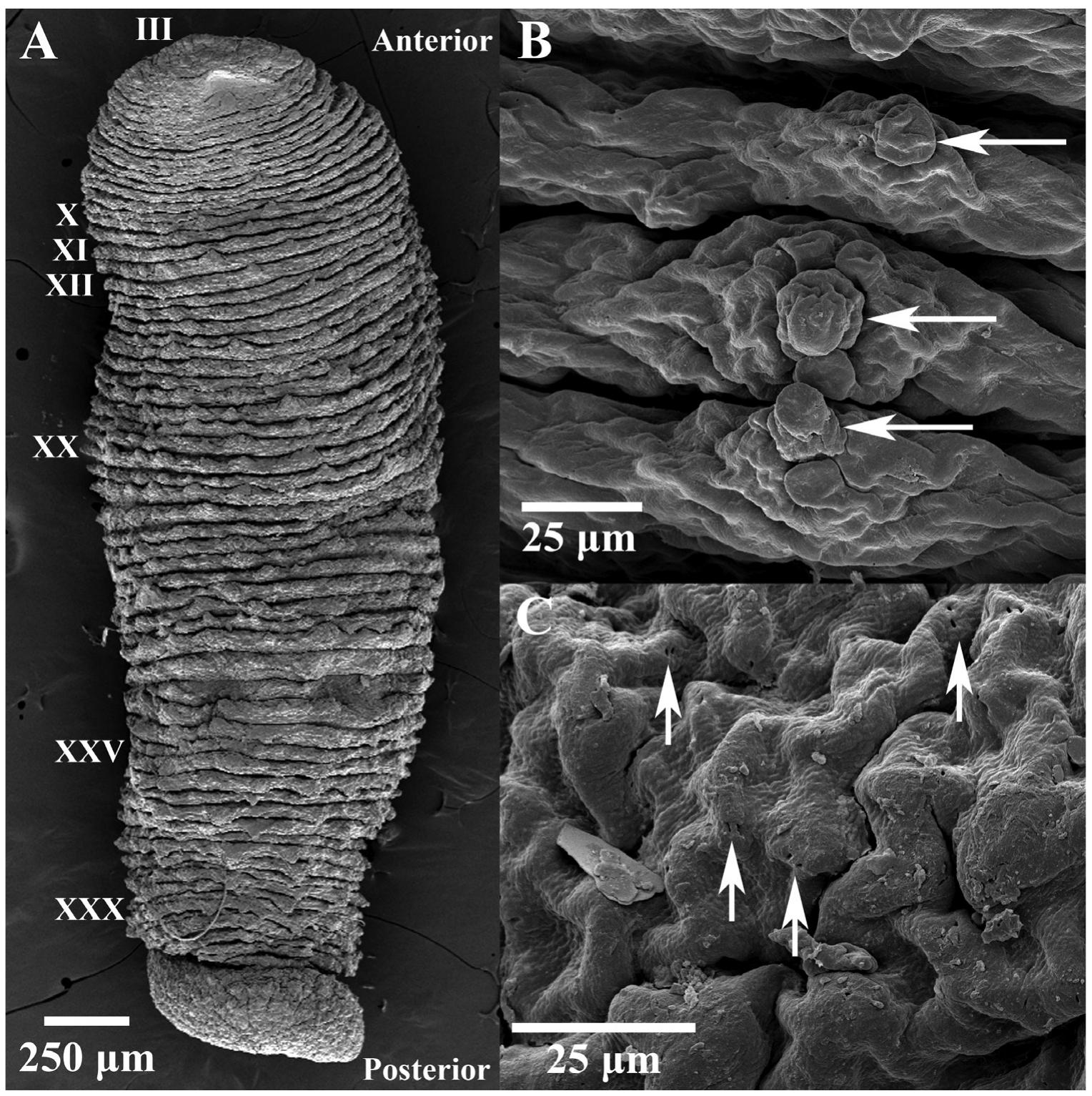 Scanning electron micrograph of dorsal surface of the