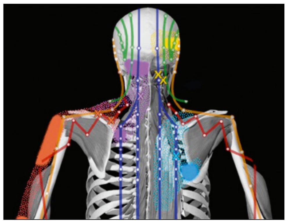 Posterior neck and upper back with teres major, teres minor,