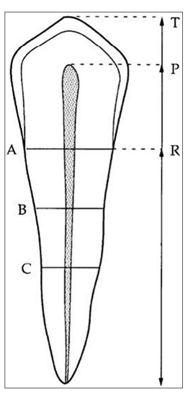 Diagram showing tooth measurements according to kvaal et