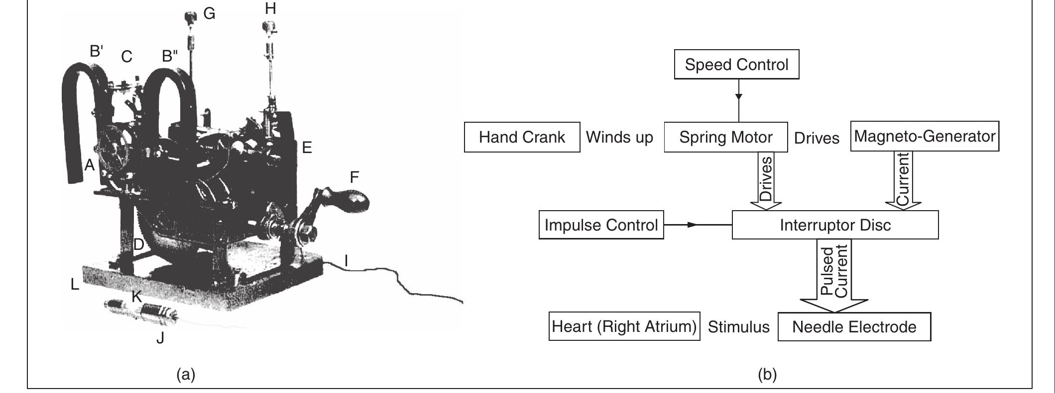 (a) the first artificial pacemaker by hyman. (6) block