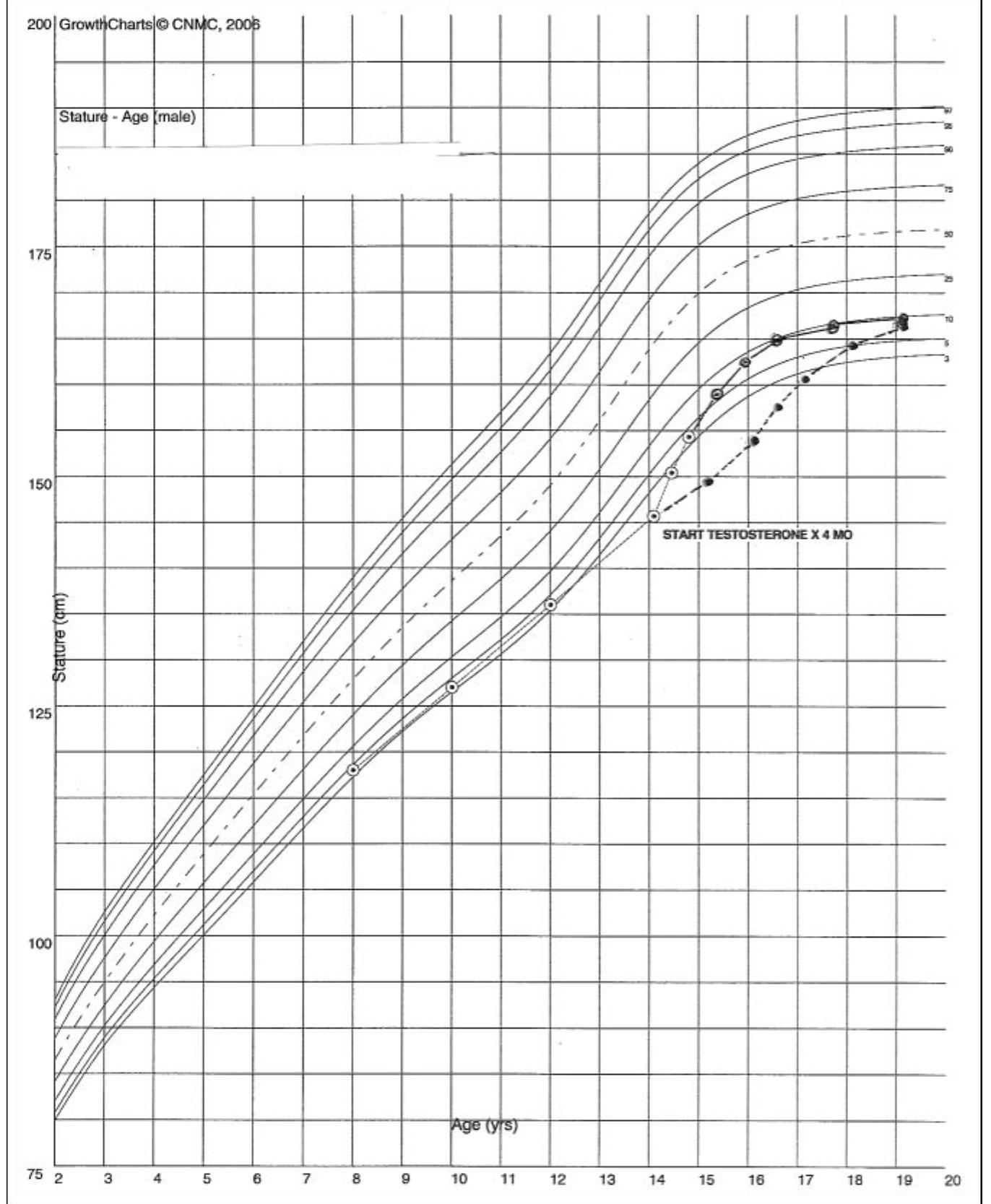 (PDF) Delayed Puberty