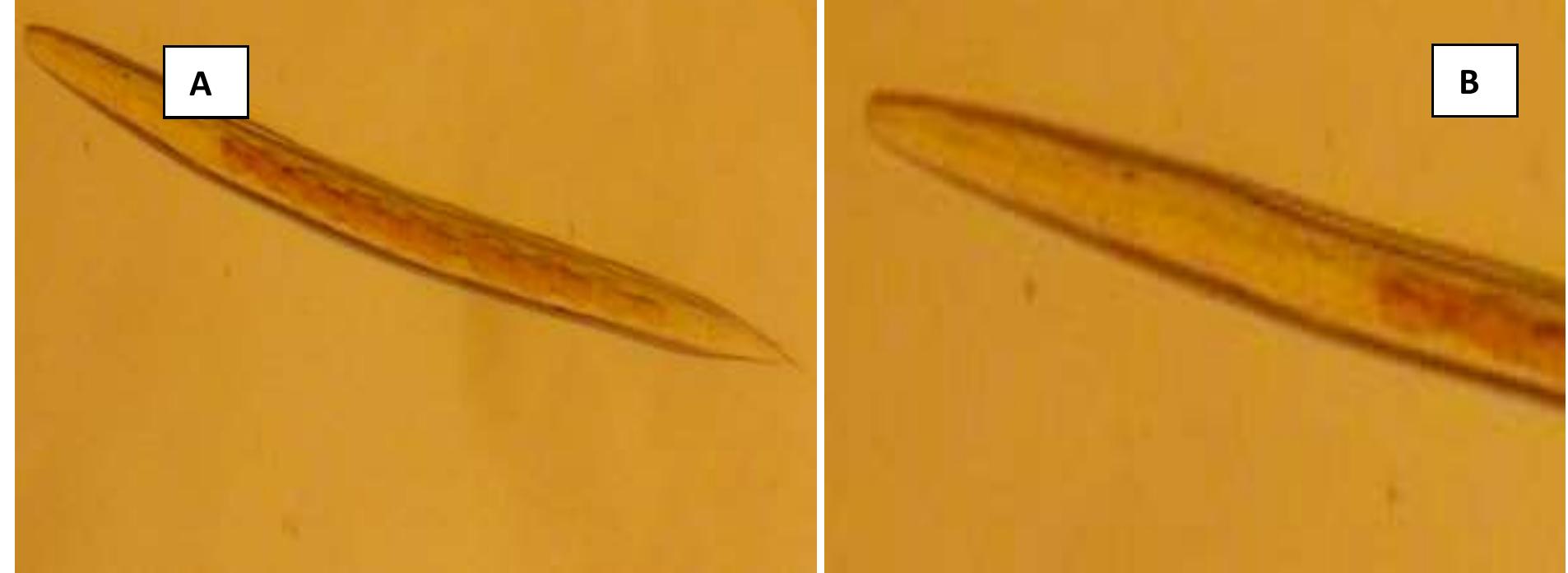 Trichostrongylus spp. third stage larva (l3); (a) rounded