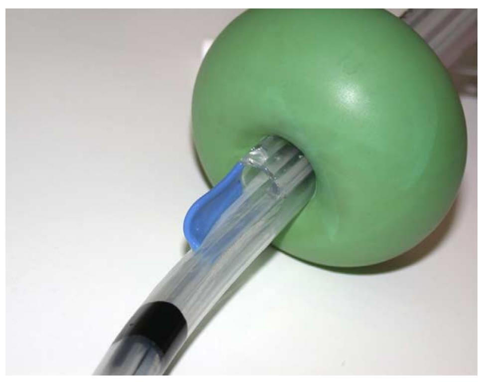 Figure 9 - Infraglottic airway devices and techniques