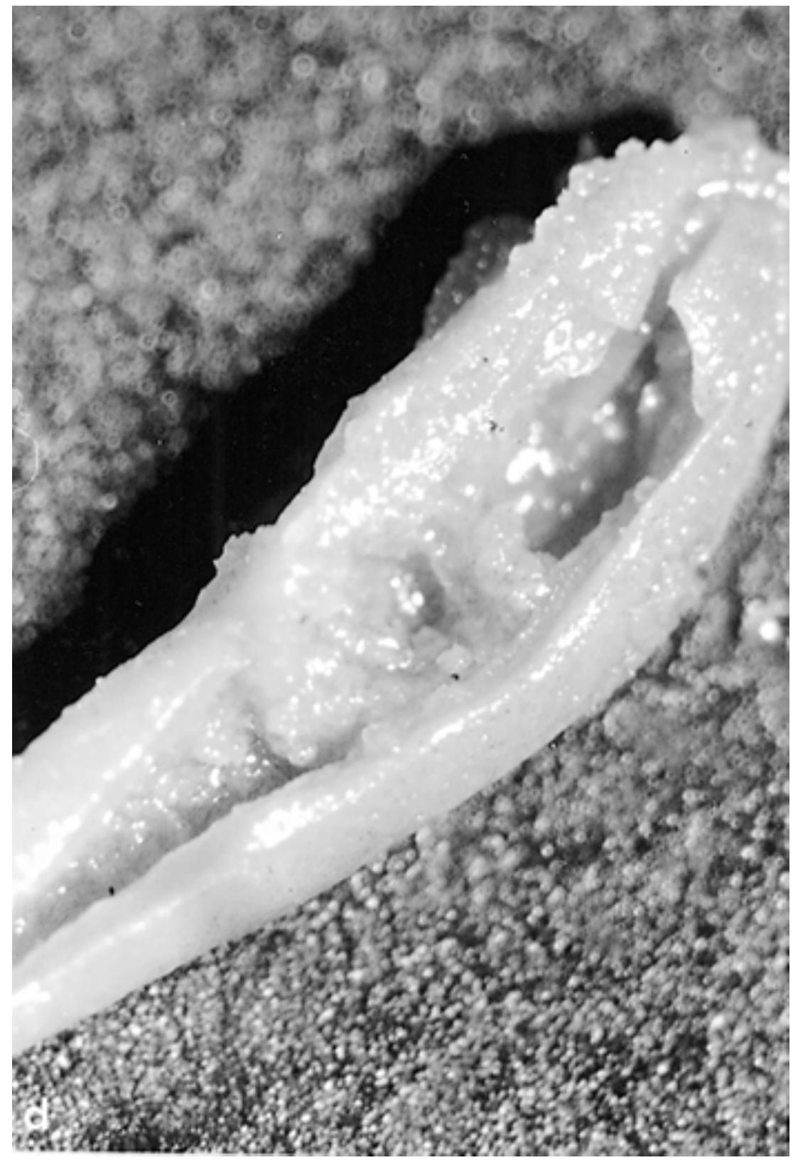 Figure 4 - The fetal gallbladder morphology and morphometry