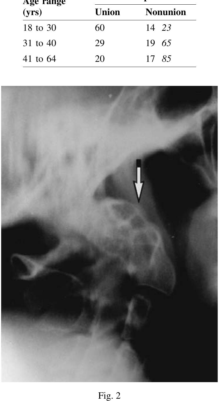 Radiograph showing malunion of a type-ii fracture with