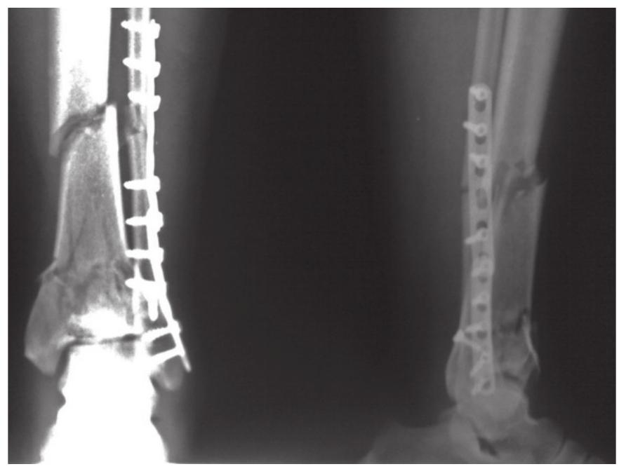 Anteroposterior and lateral view radiographs of leg with