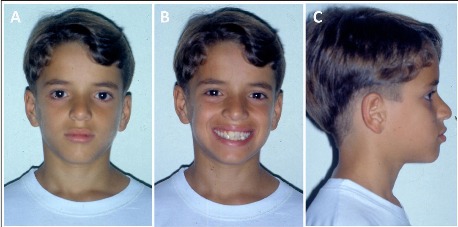 Since short- and long-term success of the orthodontic figure