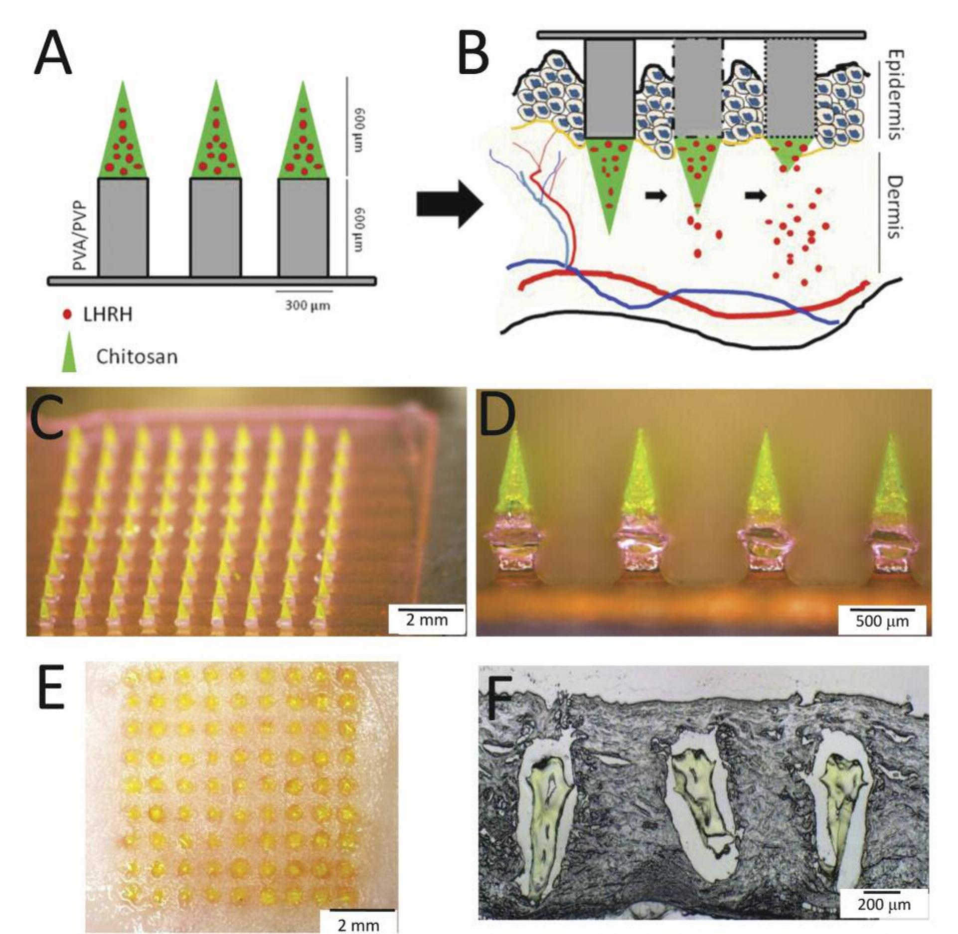 |. schematic illustration and in vitro skin penetration of