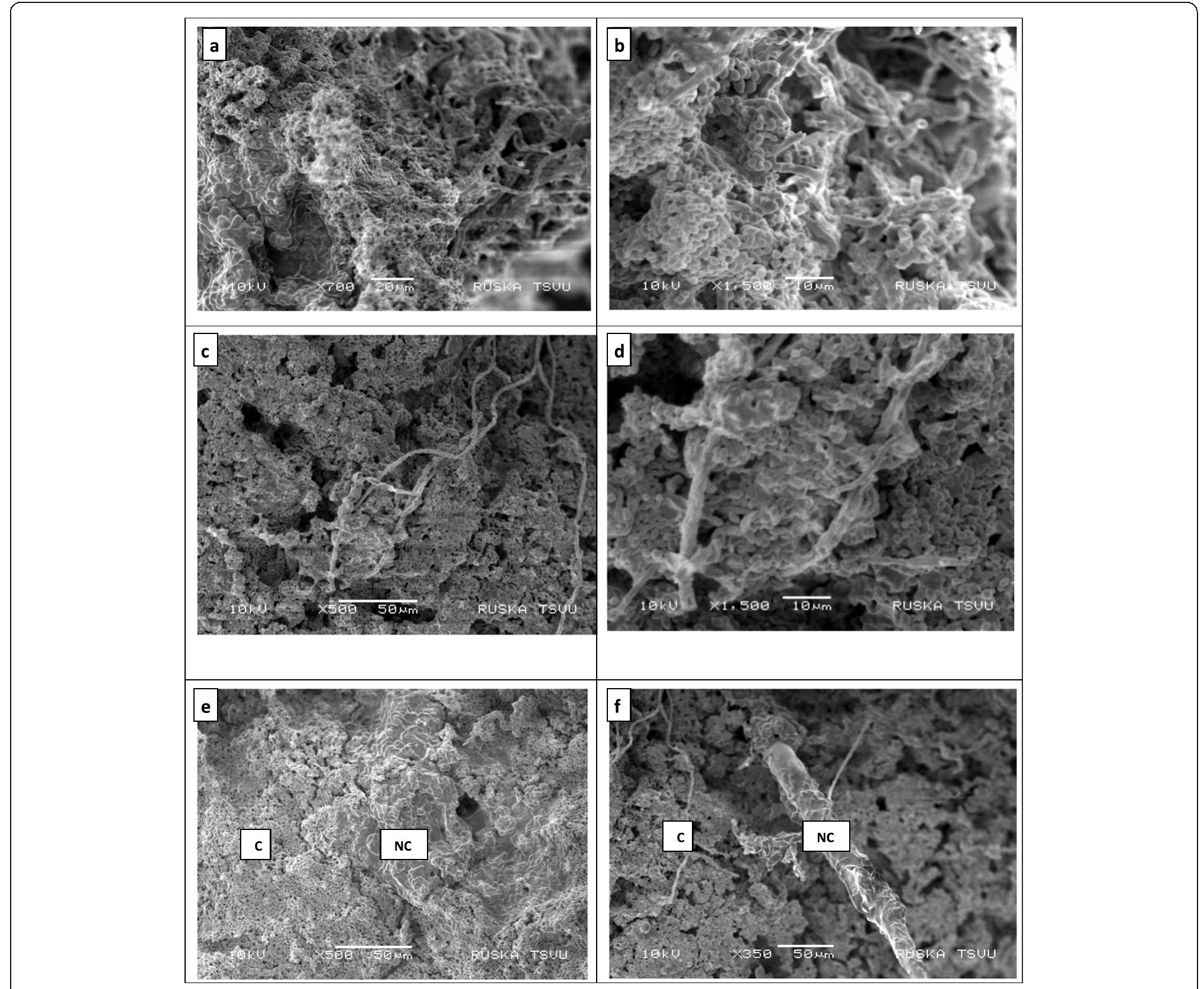 Scanning electron microscopy of metarhizium rileyi mycosis