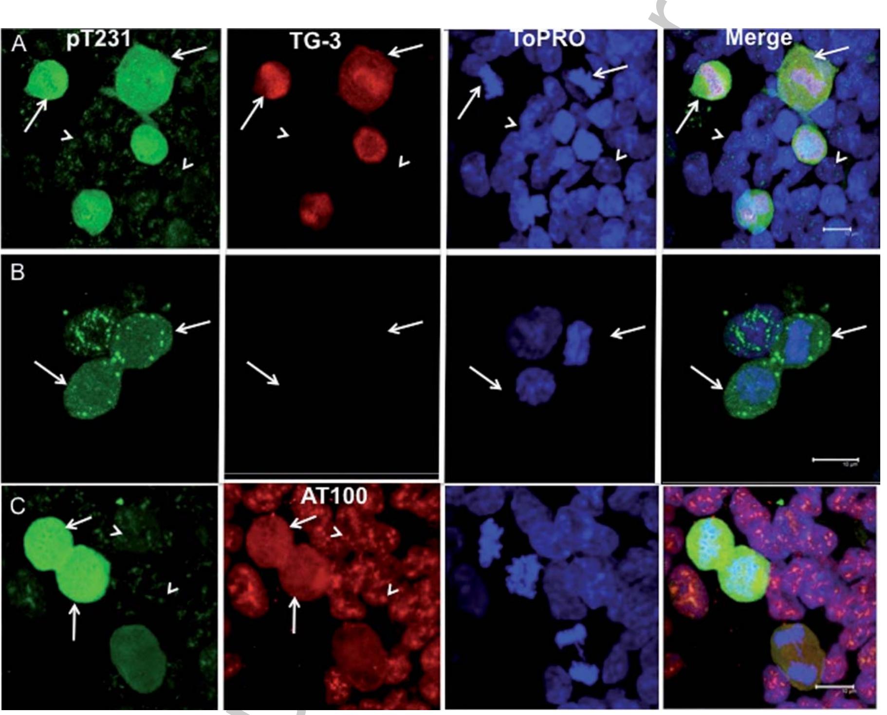Double immunostaining of undifferentiated sh-sysy cells with