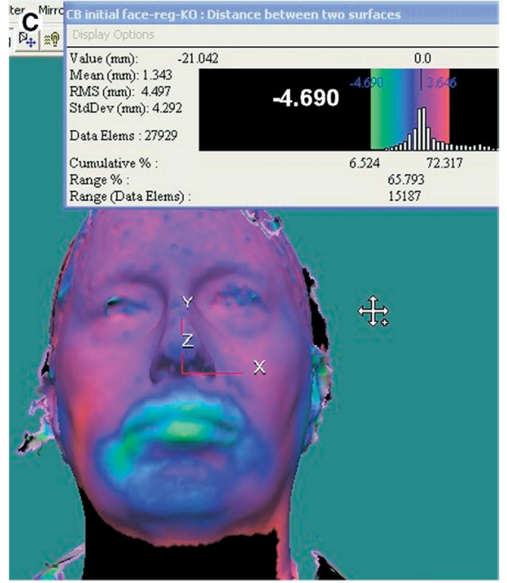 Figure 2 - from 3D Diagnosis and Treatment Planning in
