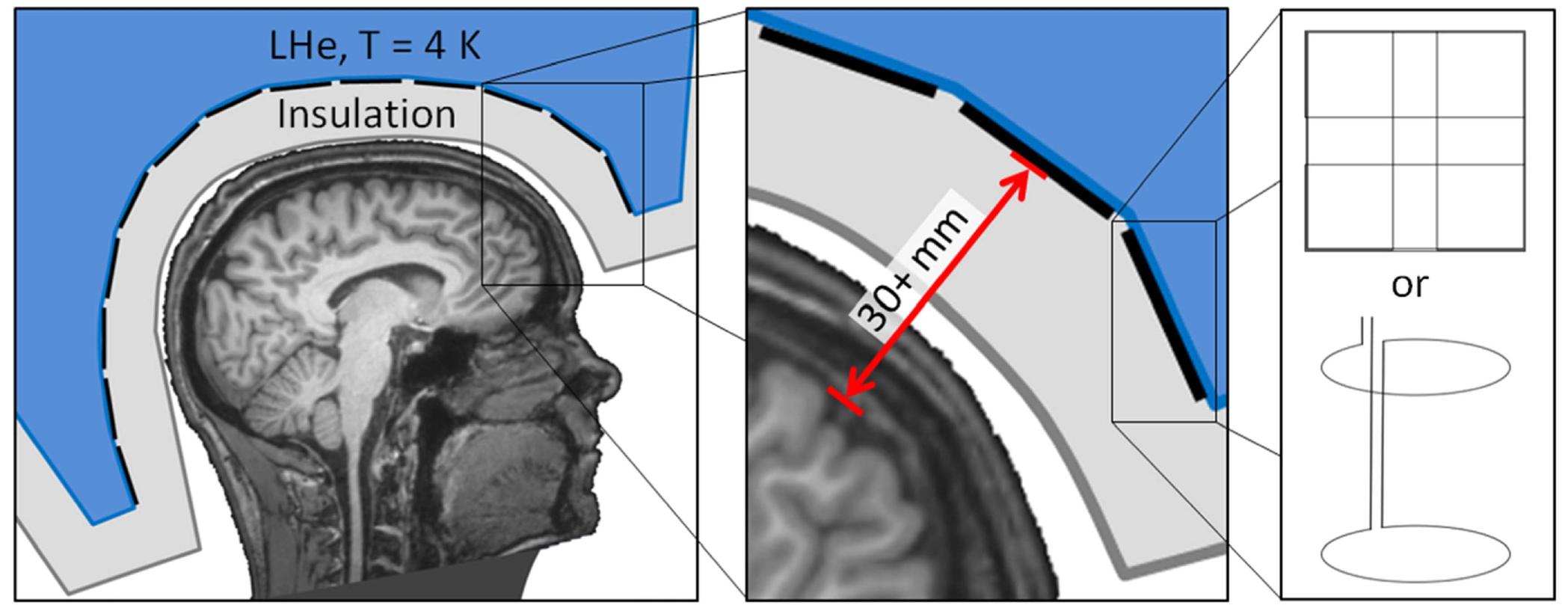 Schematic of a low-t, squid-based meg system. left: mri of